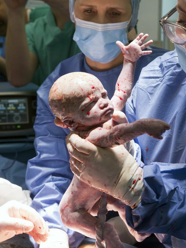 In Großbritannien bringt eine Frau mit einer gespendeten Gebärmutter ...